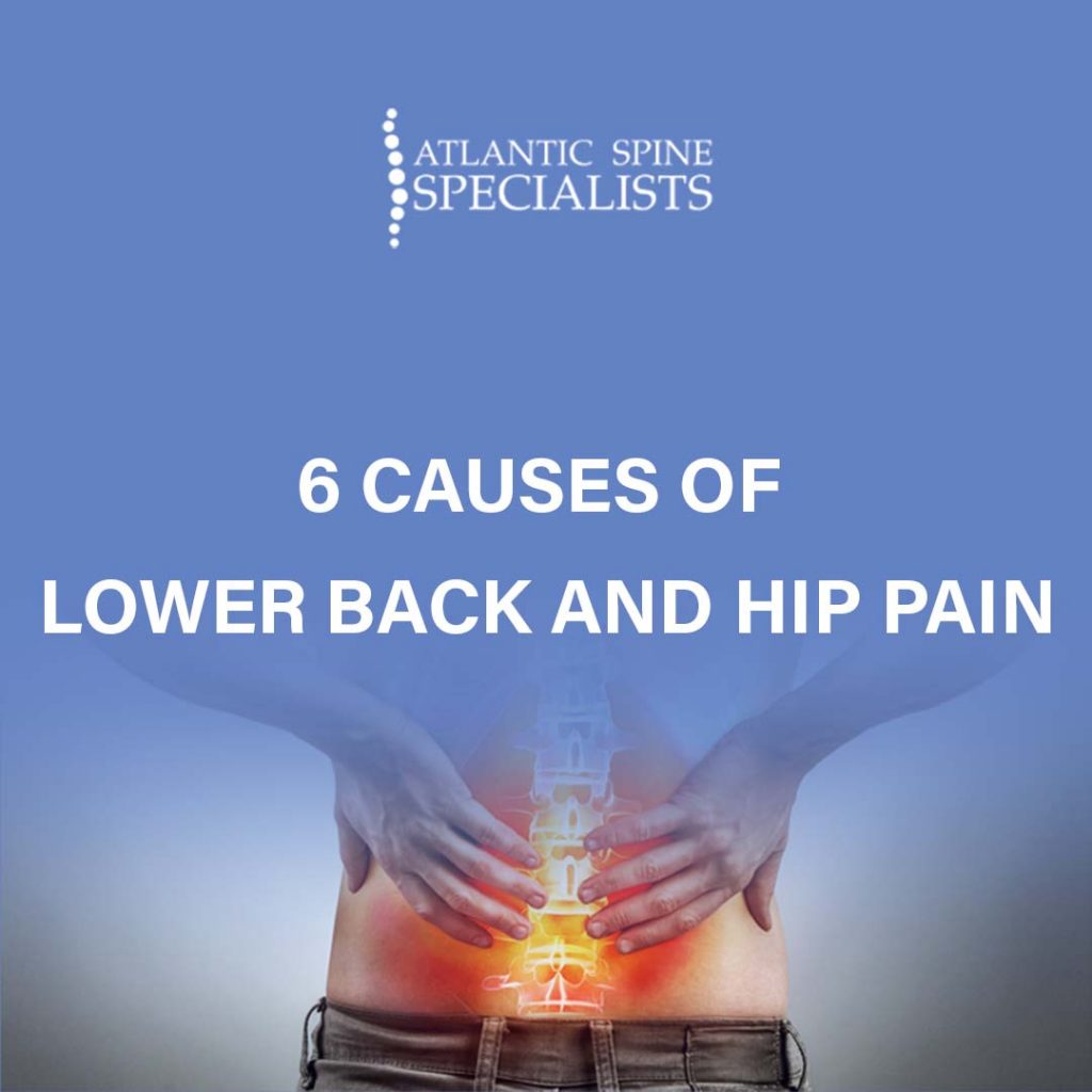 6 Causes Of Lower Back And Hip Pain Atlantic Spine Specialists 6 Causes Of Lower Back And Hip Pain Atlantic Spine Specialists