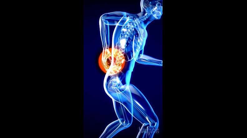 3 Signs Your Back Pain Is Something More Serious - Atlantic Spine ...